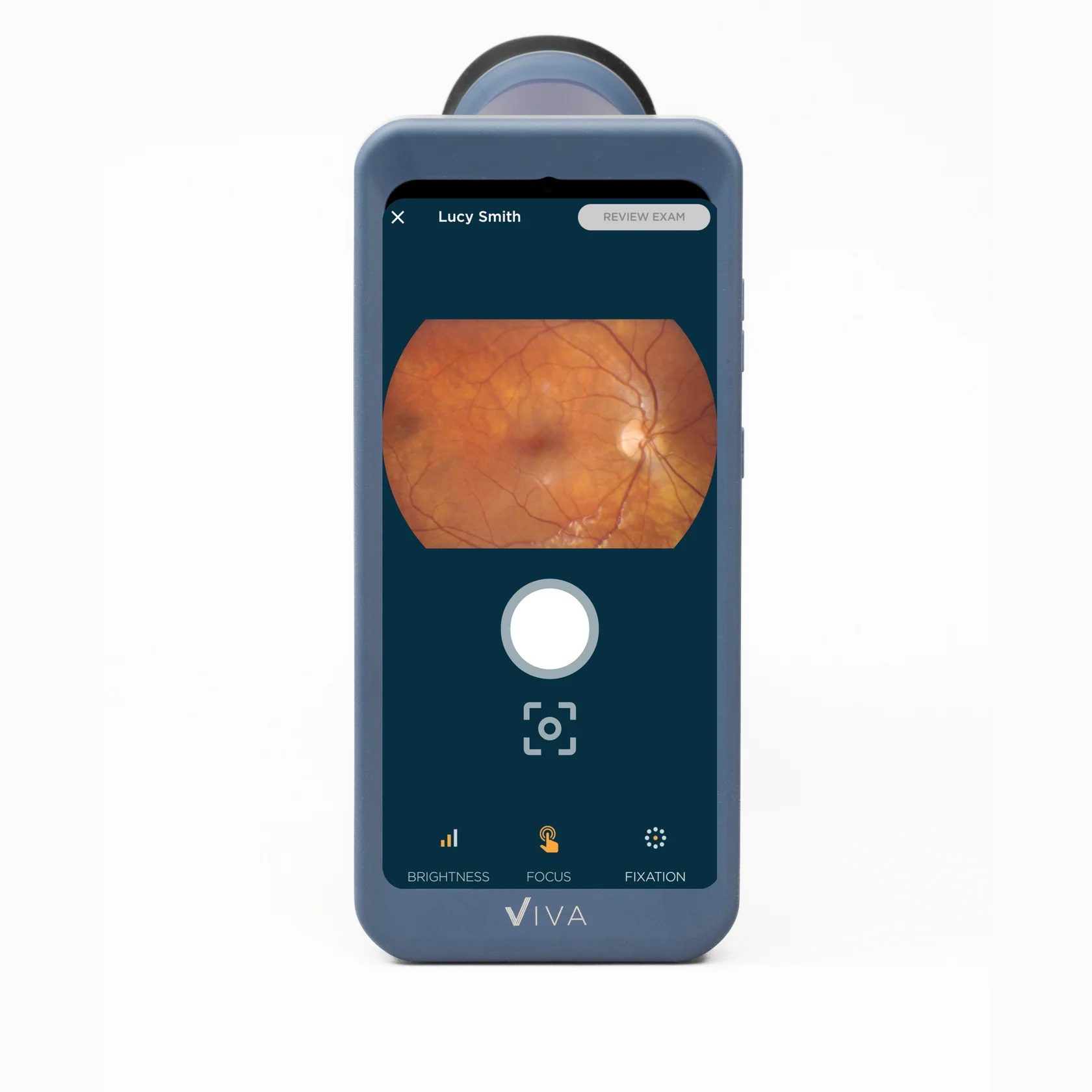 Volk Viva: Portable Non-Mydriatic Retinal Camera - InnZ Medical